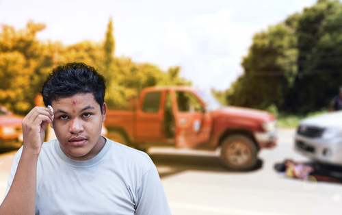 Common Car Accident-Related Face Injuries | SOL PT